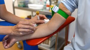 TSH ultra sensível: tudo que você precisa saber!